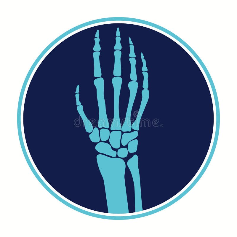 Bones of the Hand. Human Skeleton Part. Medical Illustration Vector ...