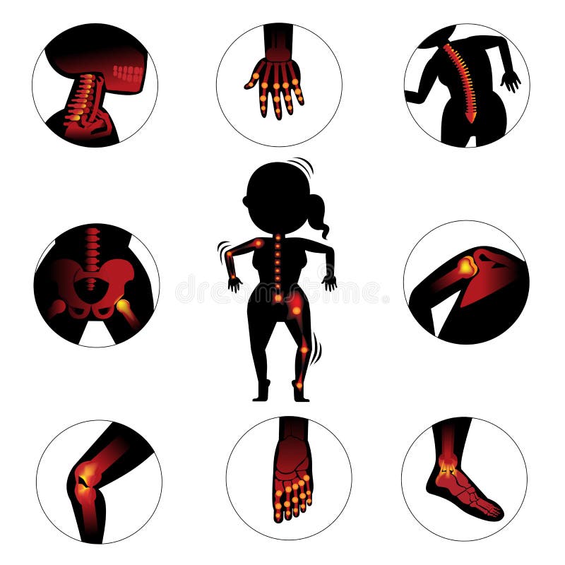 Muscle system stock vector. Illustration of muscular - 12097440