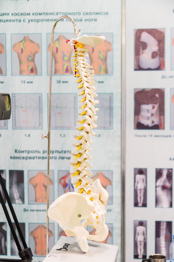 Bones layout stock photo. Image of orthopedist, care - 39485988