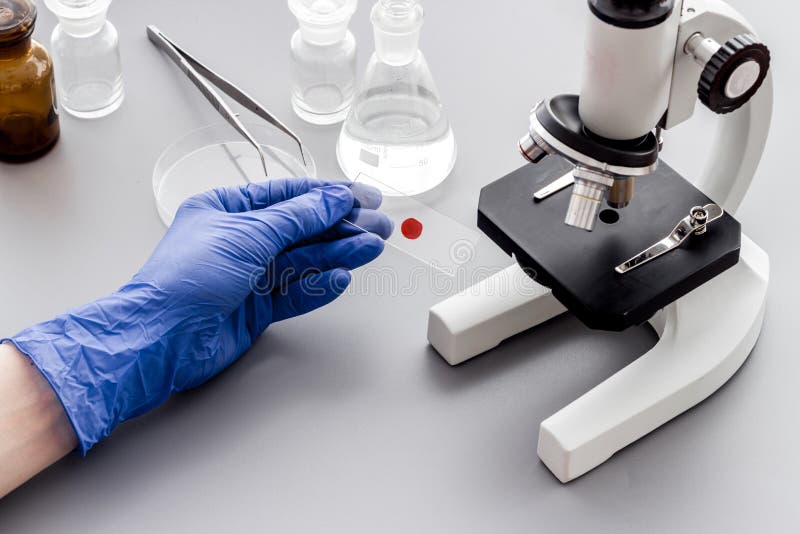 Bood Testing with Microscope in Laboratory. Sample in Hands on Blue ...