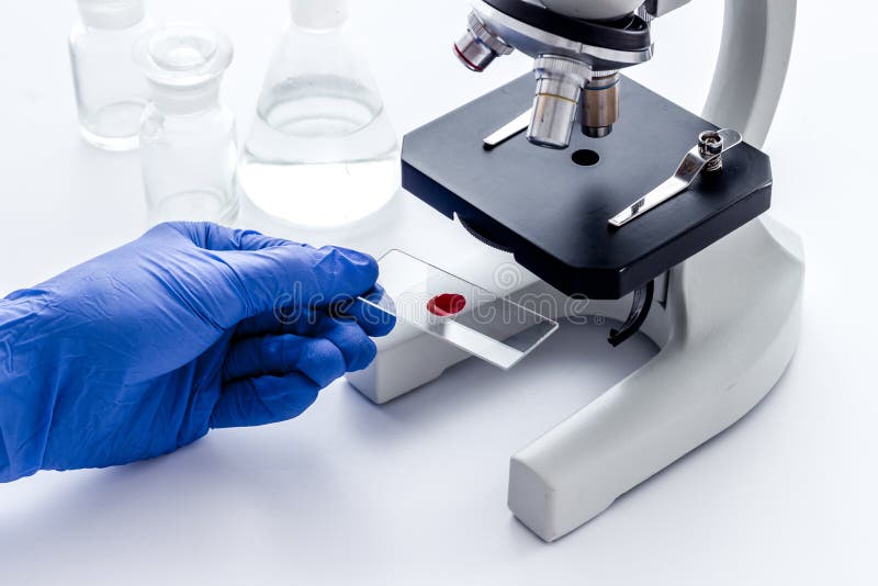 Bood Testing with Microscope in Laboratory. Sample in Hands on White ...
