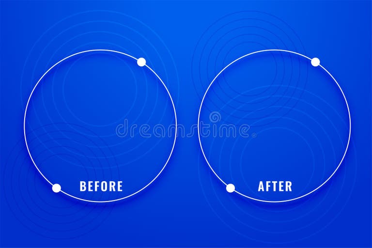Before and after Border Frame Template in Comparison Concept Stock ...