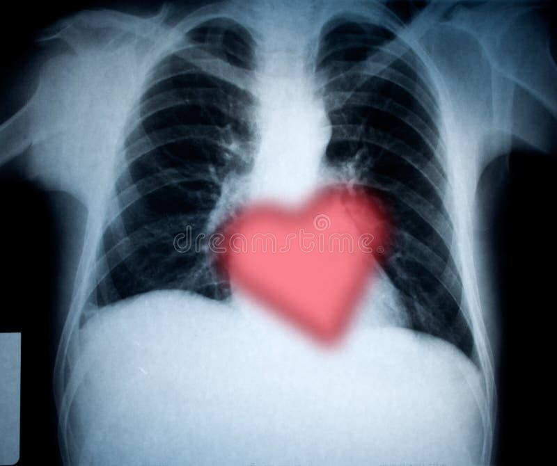 Borst en hart stock afbeelding. Image of geneeskunde, blad - 6996745