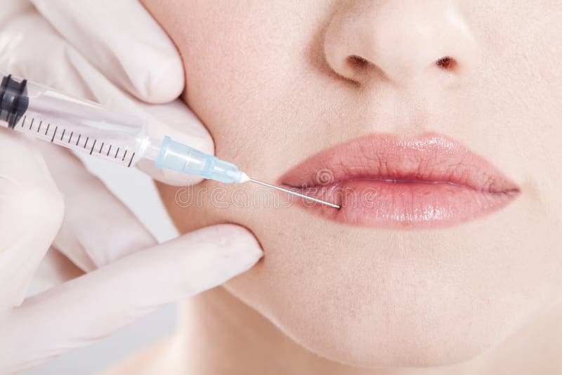 Botox injection in lip stock image. Image of lady, cosmetic - 19852985