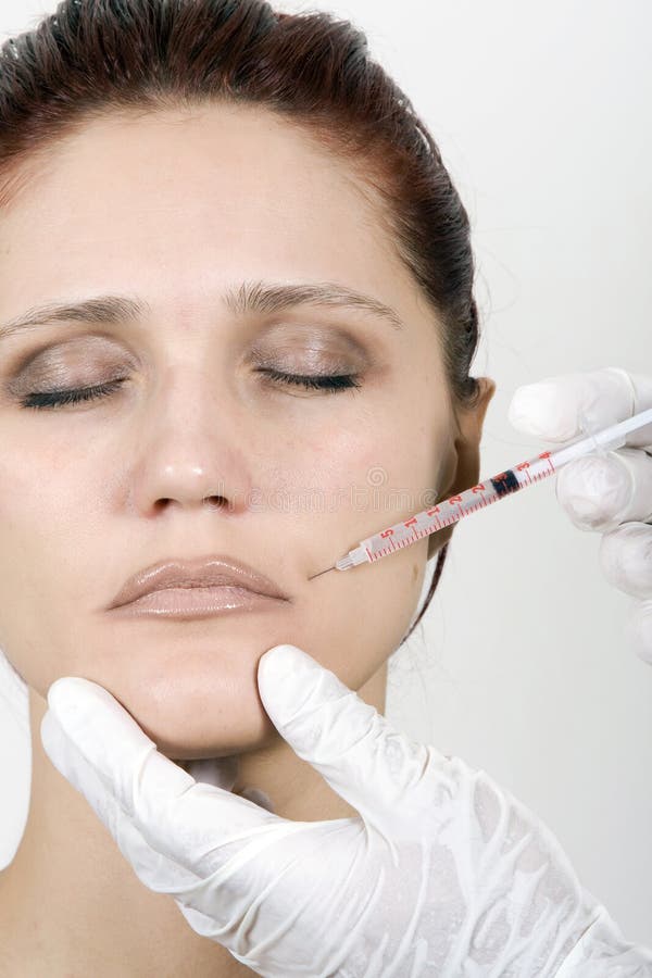 Botox injections stock photo. Image of women, people - 13364980