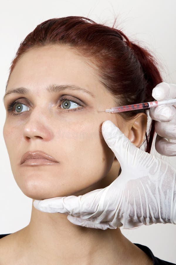 Botox injections stock photo. Image of medical, treatment - 13365006