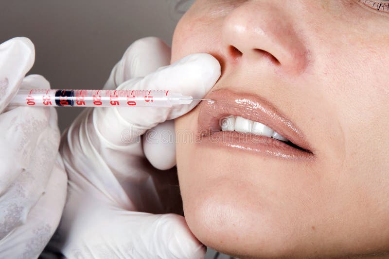 Botox Injections in Her Lips Stock Photo - Image of human, adult: 13365080