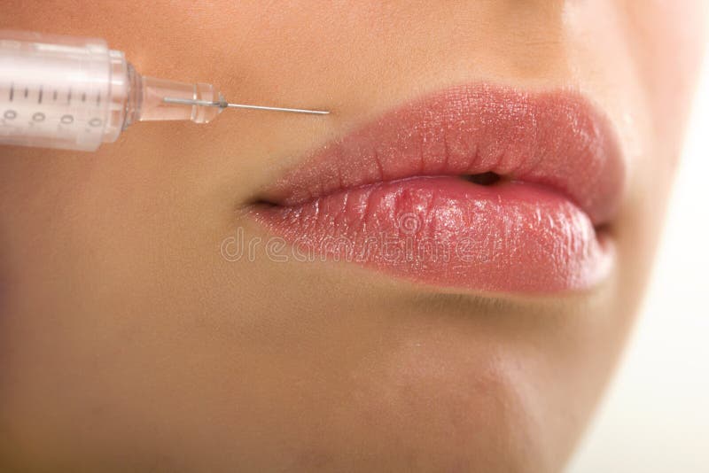 Botox Shot in the Female Cheek Stock Image - Image of face, injuring ...