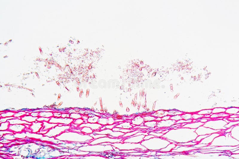 Botrytis Allii Under the Microscope Stock Image - Image of education ...