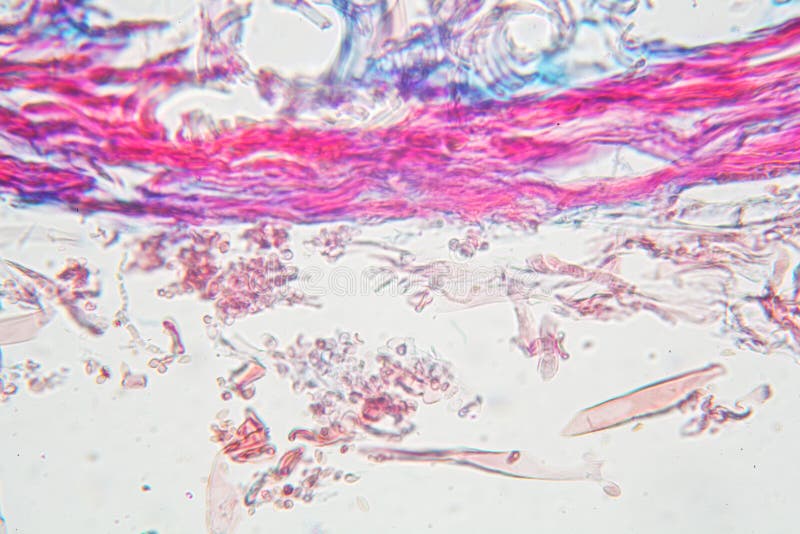 Botrytis Allii Unter Dem Mikroskop Stockfoto - Bild von pilzartig ...