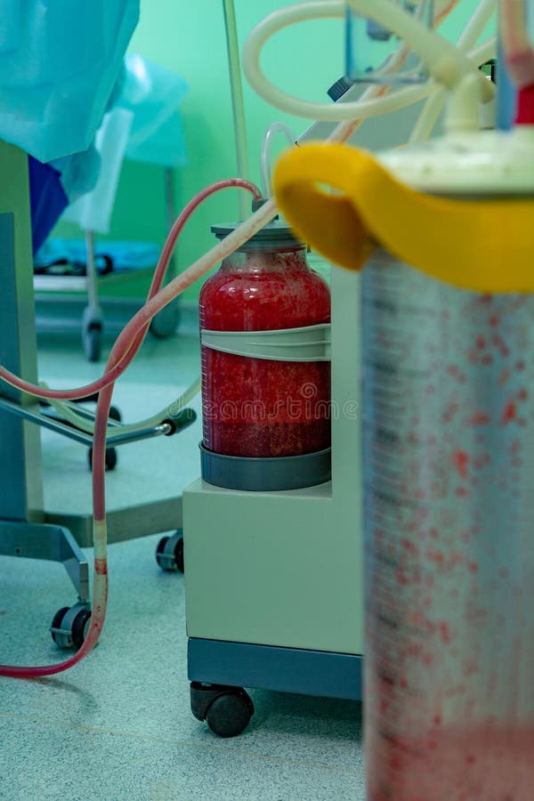 The Bottles for the Fat Liquid from Liposuction Stock Photo - Image of ...