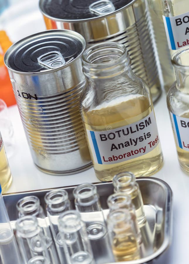 Botulism Samples in Laboratory Stock Photo - Image of green, biology ...