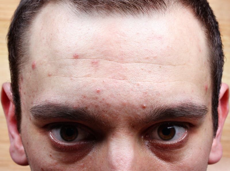 Photos de Stress De Sensibilisation - Photos de stock gratuites et ...