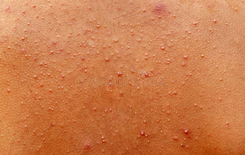 7,782 Photos de Bouton Sur La Peau - Photos de stock gratuites et ...