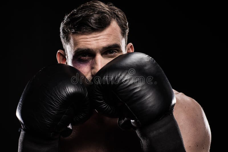 Boxer with black eye stock image. Image of exercising - 90343813