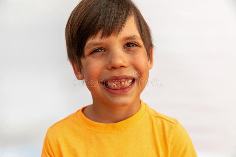 A Boy without Anterior Teeth Smiles, on White Background Stock ...