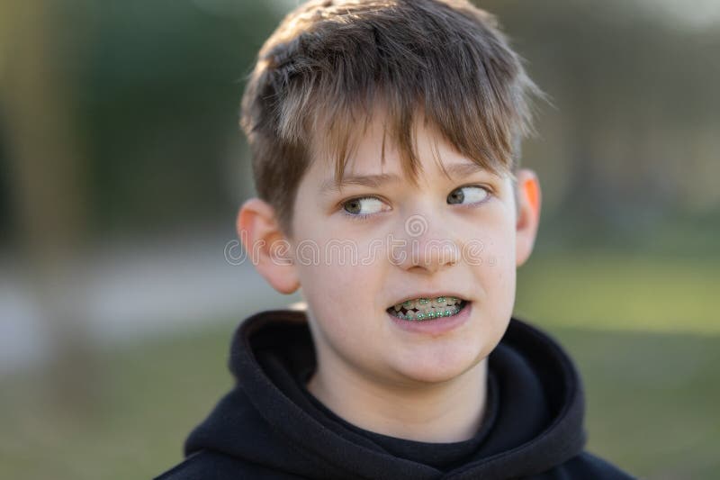 A Boy with Braces is Wearing a Black Hoodie Stock Photo - Image of look ...