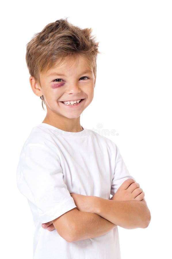 Boy with bruise stock photo. Image of health, abuse, background - 42937062