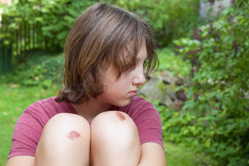 Boy Scab Stock Photos - Free & Royalty-Free Stock Photos from Dreamstime