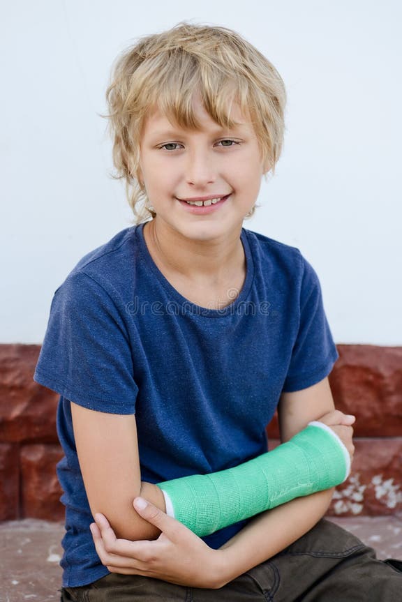 Boy with cast stock image. Image of cast, boyhood, looking - 32835867