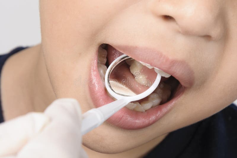 Boy Checking Tooth by Mirror Stock Photo - Image of close, patient ...