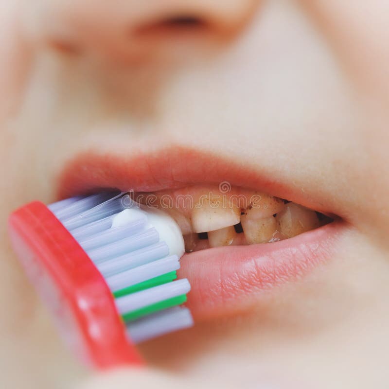 5,198 Dirty Teeth Stock Photos - Free & Royalty-Free Stock Photos from ...