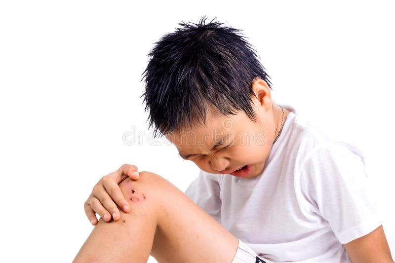 Boy Feel Pain from a Dry Wound Stock Photo - Image of knee, health ...