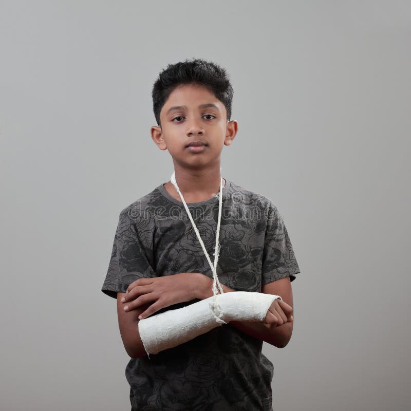Boy with a fractured hand stock photo. Image of recovery - 152087116