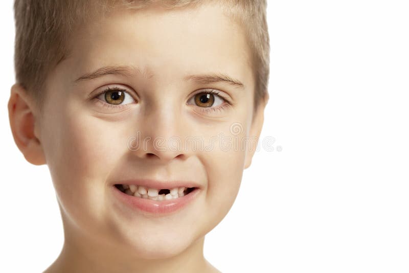 Young Boy Smiles Missing Teeth Stock Photos - Free & Royalty-Free Stock ...