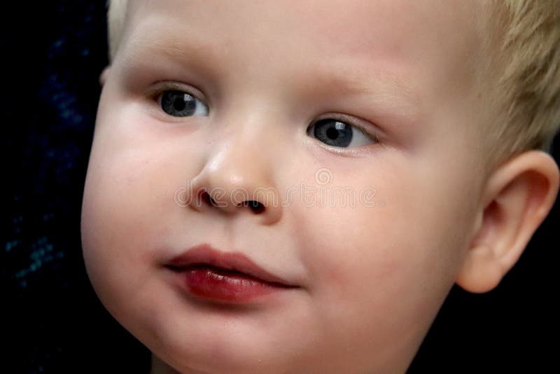 The Boy Has a Broken Wound on the Lips Stock Image - Image of hygiene ...