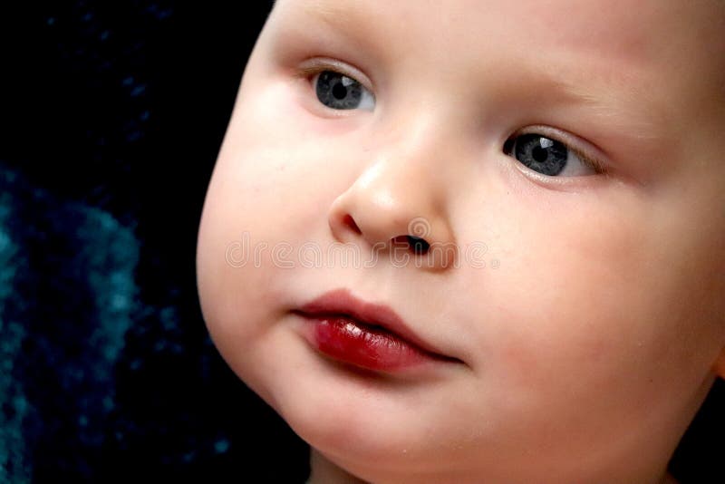 The Boy Has a Broken Wound on the Lips Stock Image - Image of bloated ...