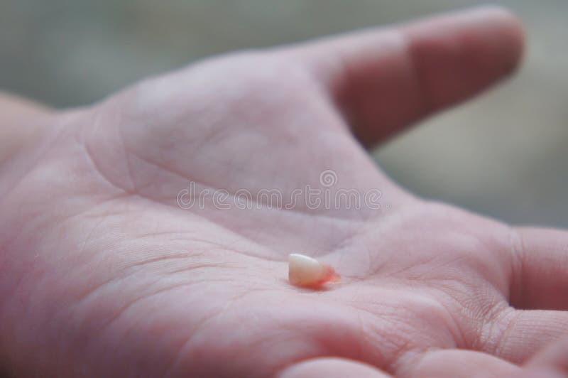 Boy His Hands Held White Tooth Had Fallen Out Child Stock Photos - Free ...