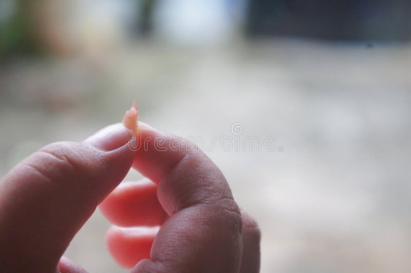 Boy His Hands Held White Tooth Had Fallen Out Child Close Range Stock ...