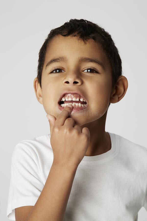Boy with loose tooth stock photo. Image of hygiene, touching - 50602508
