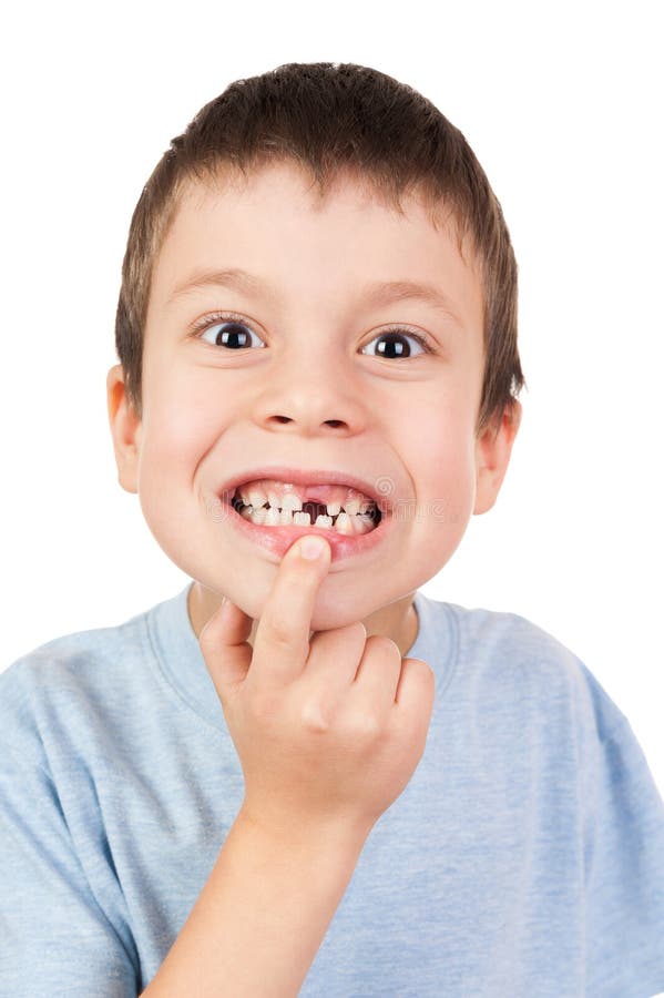 Boy Portrait with a Lost Tooth Stock Photo - Image of positive, good ...
