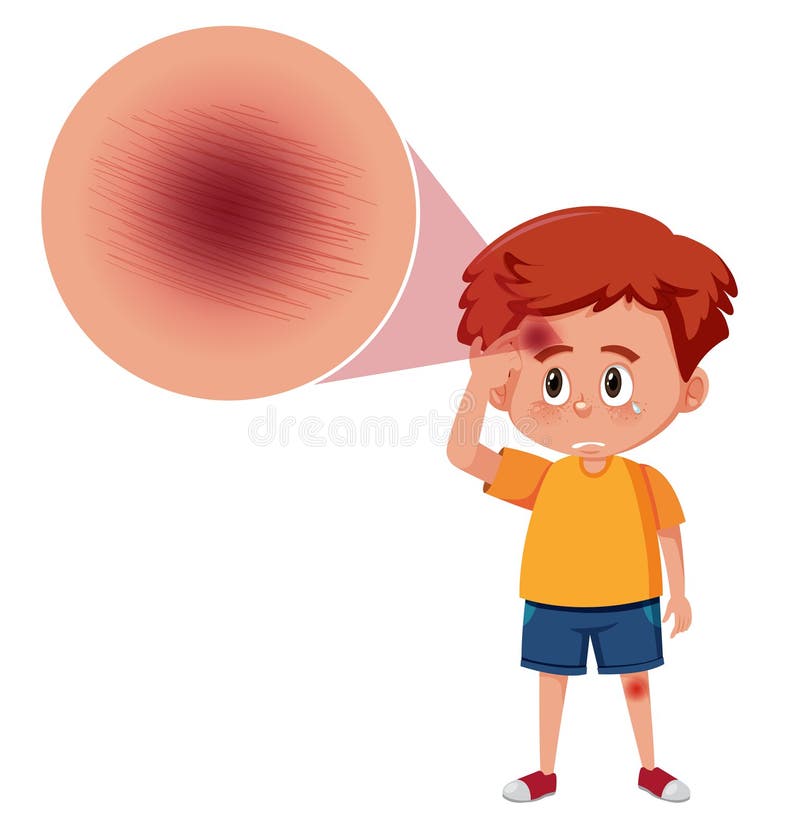 Forehead Stock Illustrations – 6,913 Forehead Stock Illustrations ...