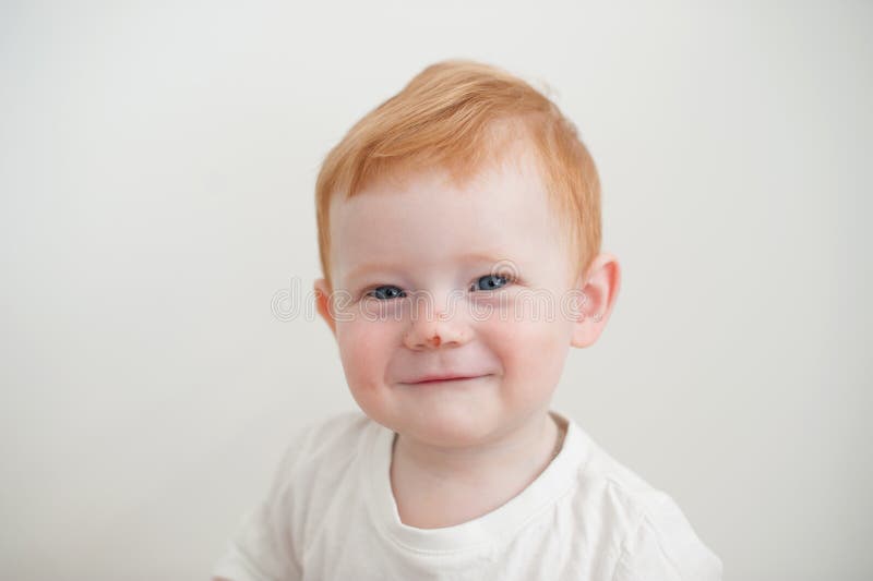A Boy with a Scratch on His Nose Stock Image - Image of european ...