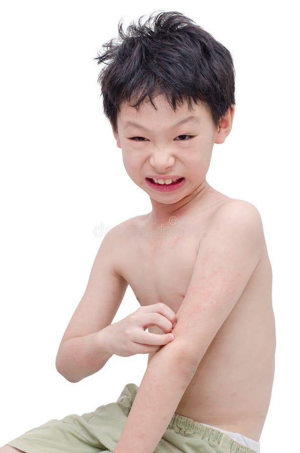 Boy Scratching His Allergic Skin Stock Photo - Image of body, isolated ...