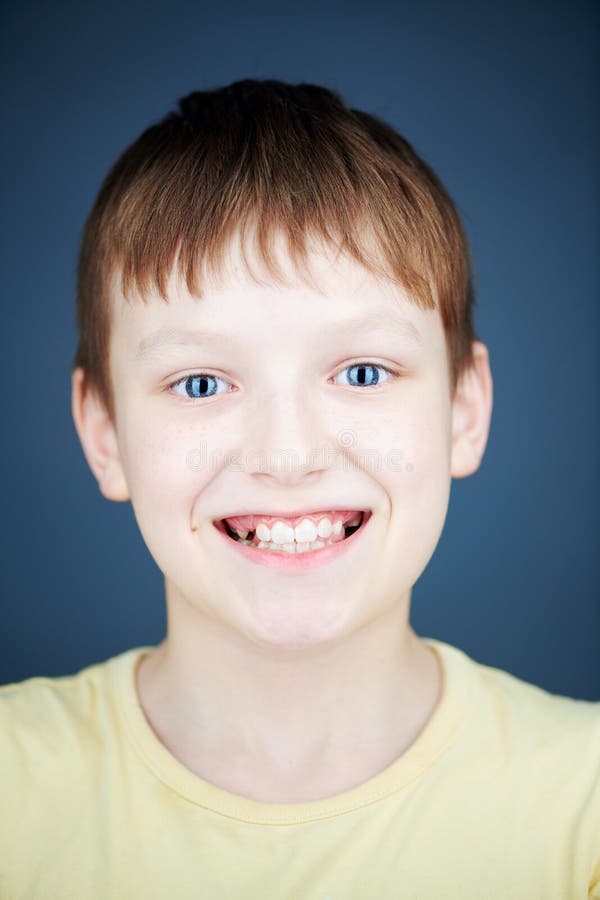 Boy through a Smile Shows Teeth on a Blue Background Stock Photo ...