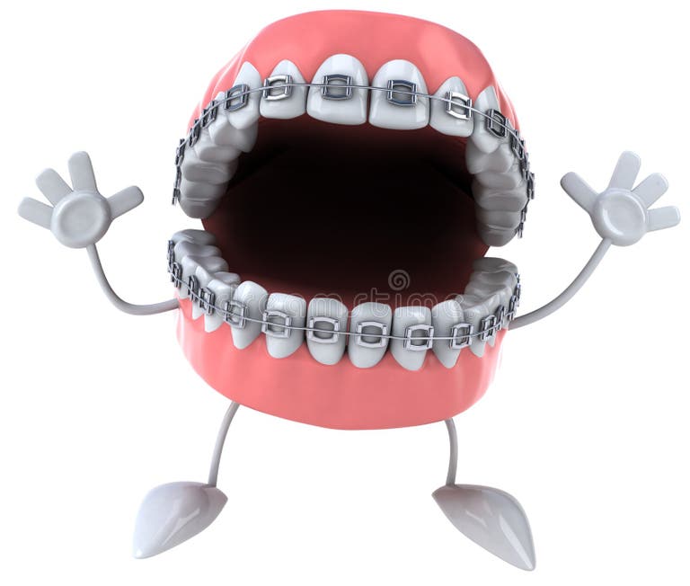 Braces Funny Teeth Stock Illustrations – 735 Braces Funny Teeth Stock ...