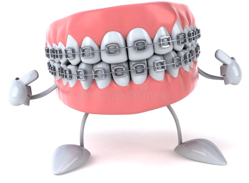 Teeth with Braces or Brackets on White. Dental Care Con Stock ...