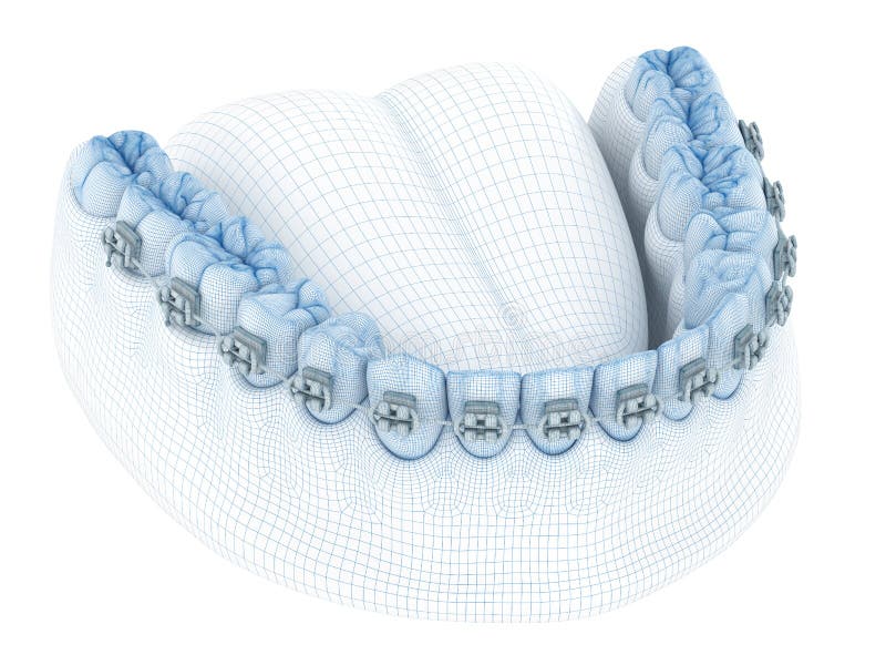 1,023 Denture Unstable Illustration Stock Photos - Free & Royalty-Free ...