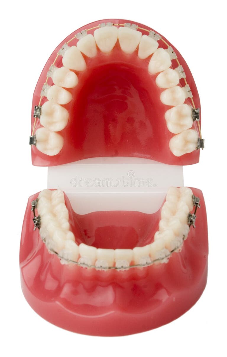 9,431 Braces Model Stock Photos - Free & Royalty-Free Stock Photos from ...