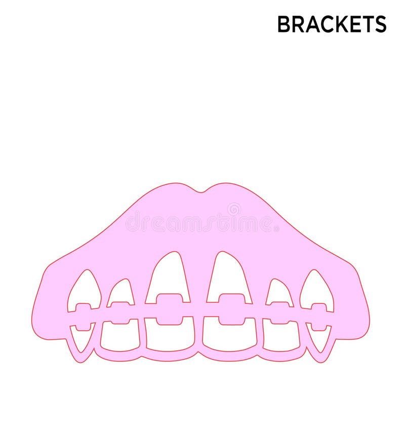 Brackets Icon Expand To Any Size, Change To Any Color Stock Vector ...