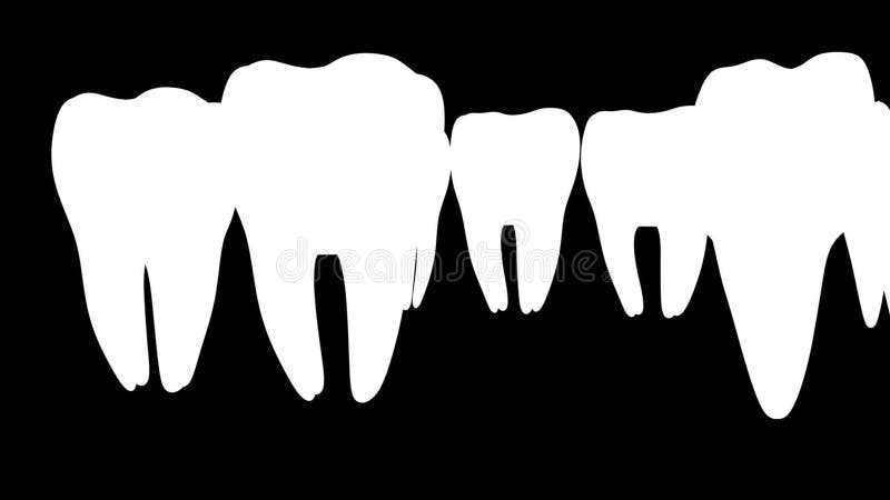 Animation dental brackets stock video. Video of cosmetic - 101454829