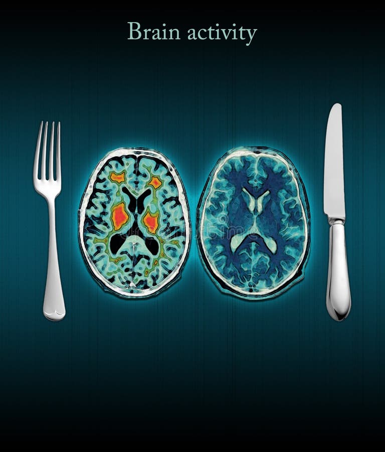 Brain Empty Stock Illustrations – 4,380 Brain Empty Stock Illustrations ...