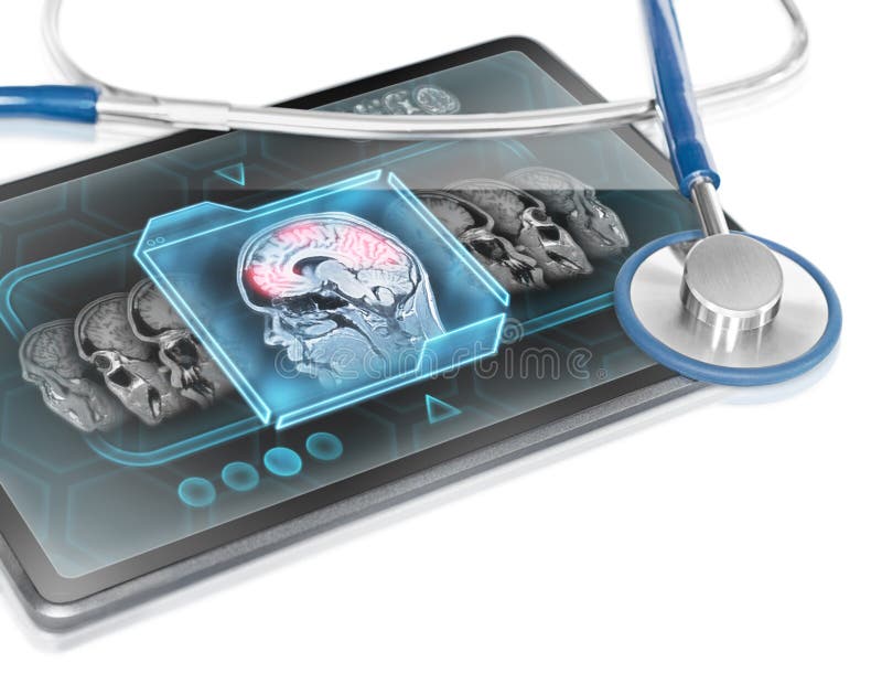 Brain activity MRI scan stock image. Image of clinical - 161794135