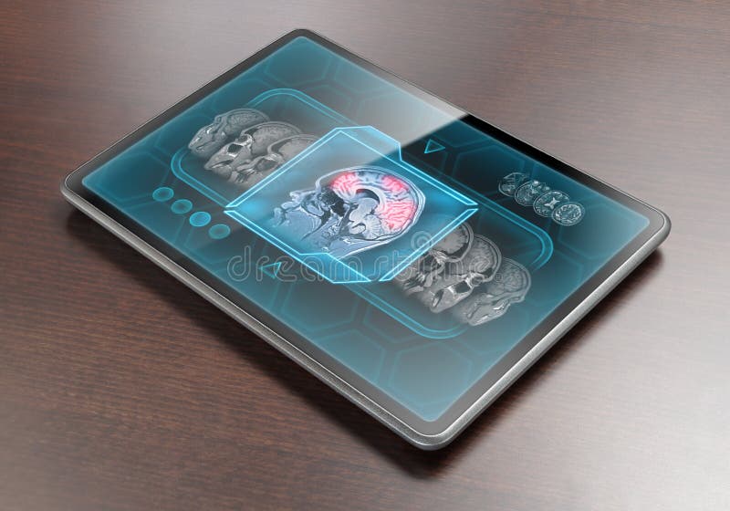 Brain activity MRI scan stock image. Image of clinical - 161794135