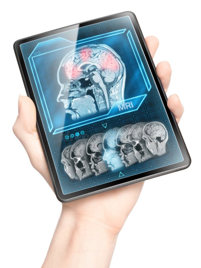 Brain activity scan stock photo. Image of device, medic - 135186274