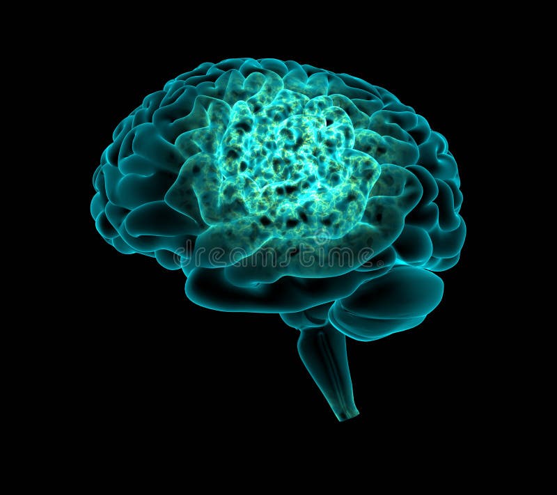 Brain activity spot stock illustration. Illustration of psicology ...
